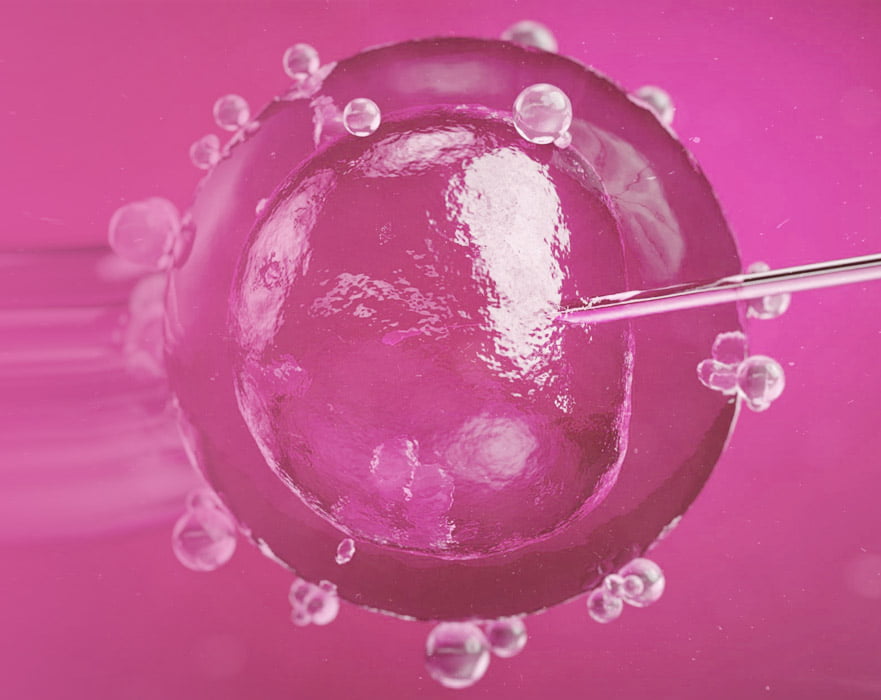 IVF Treatment in Turkey - Gynist IVF Clinic - IVF Turkey, infertilite ...